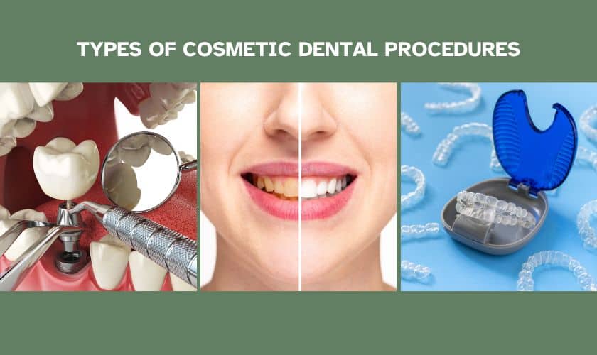 Different Types of Cosmetic Dental Procedures